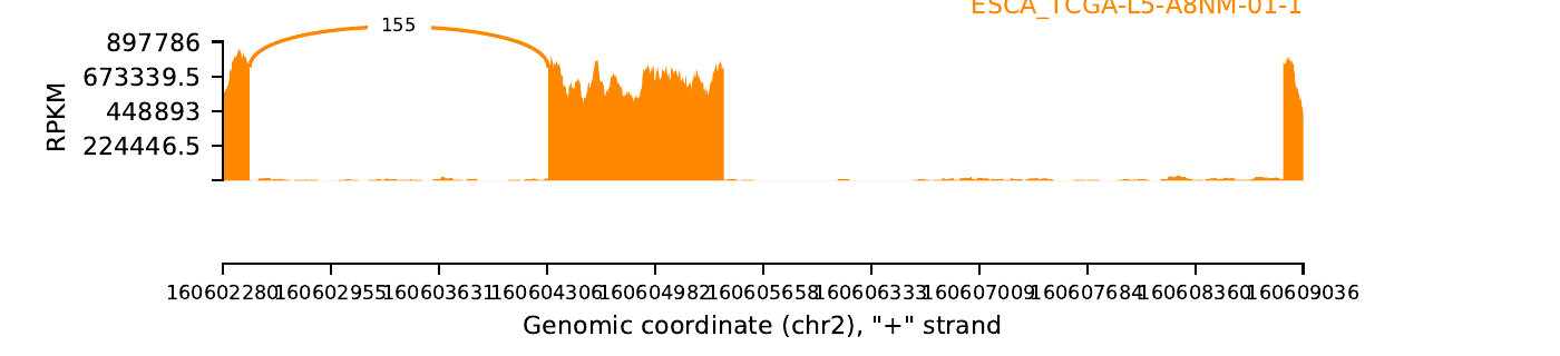 ExonSkipDB: functional annotation of exon skipping event in human - Search